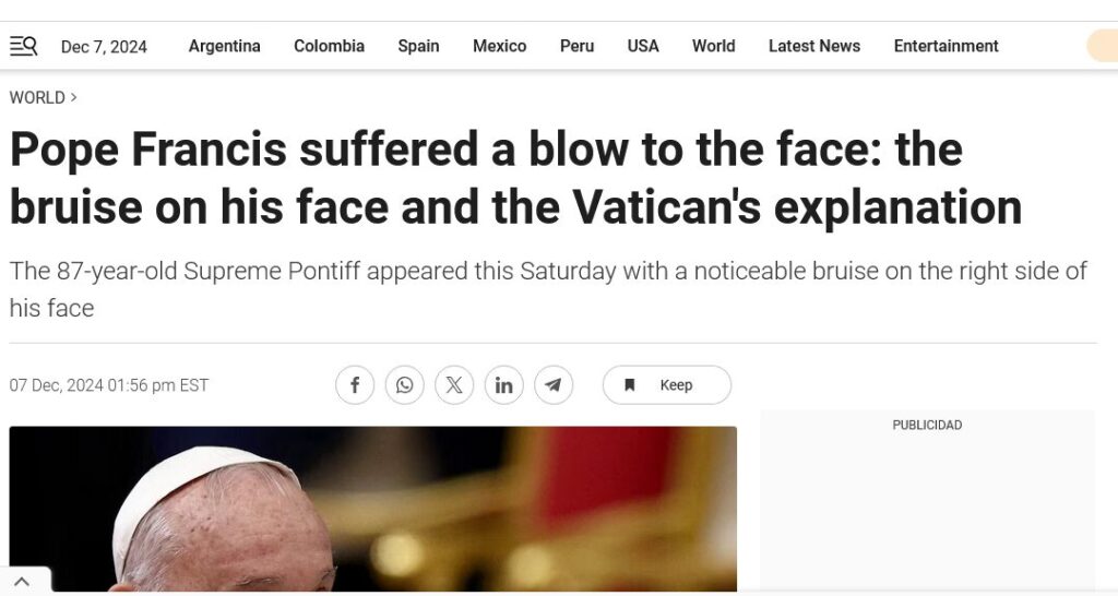 Pope Francis hit his bedside table and suffers major contusion | From Rome
